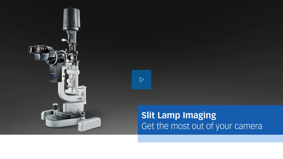 Slit lamp imaging