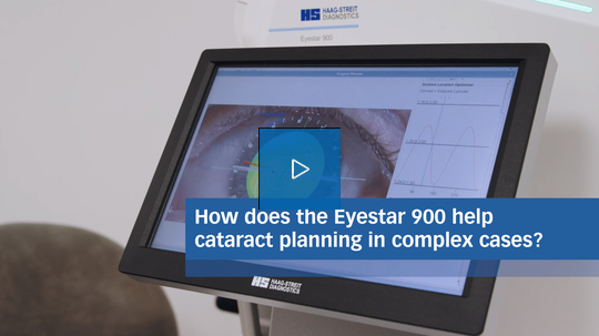 Eyestar 900