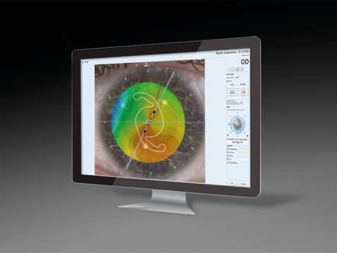 Lenstar 900 - EyeSuite IOL