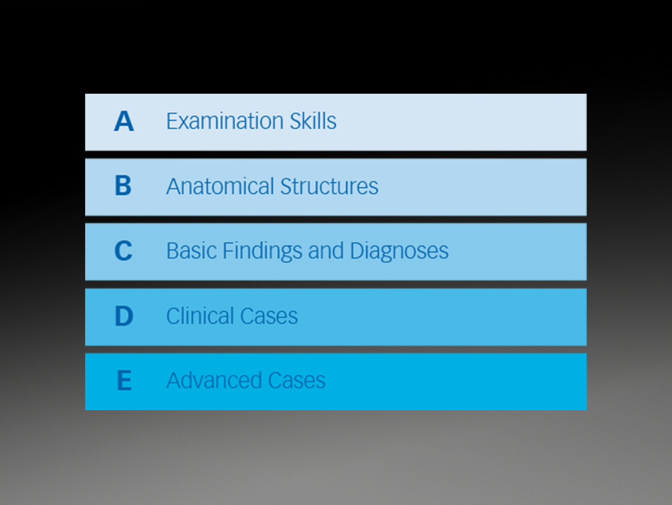 Eyesi Indirect Ophthalmoscope