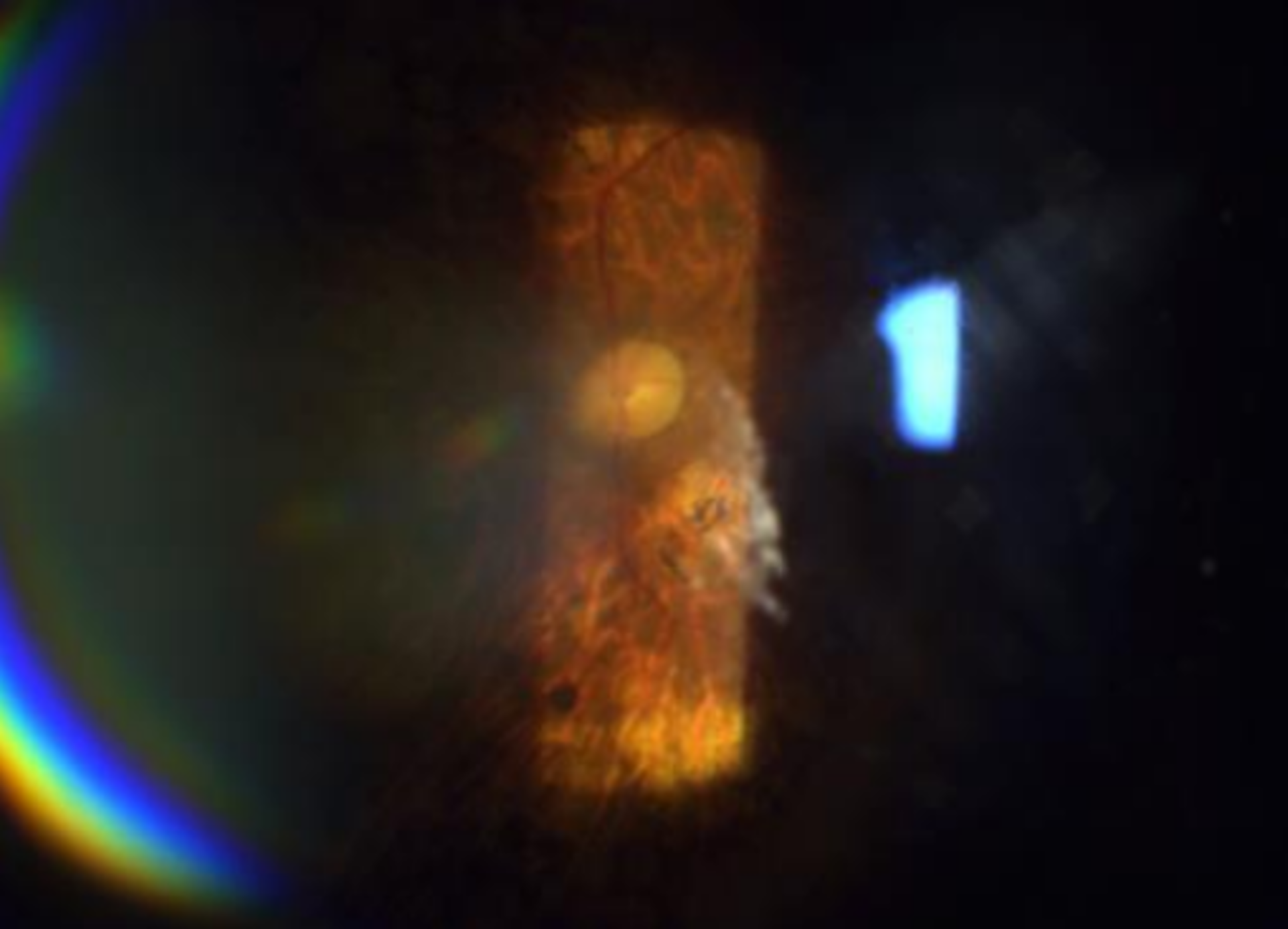 Haag-Streit Slit lamps