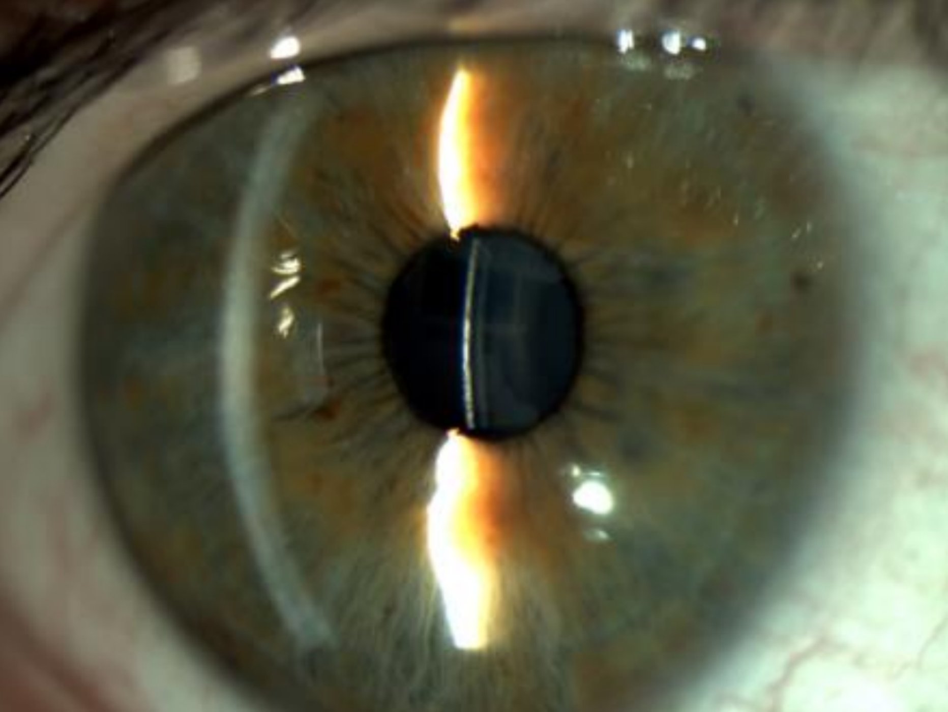 Haag-Streit Slit lamps