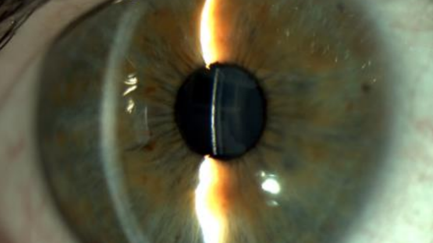 Haag-Streit Slit lamps