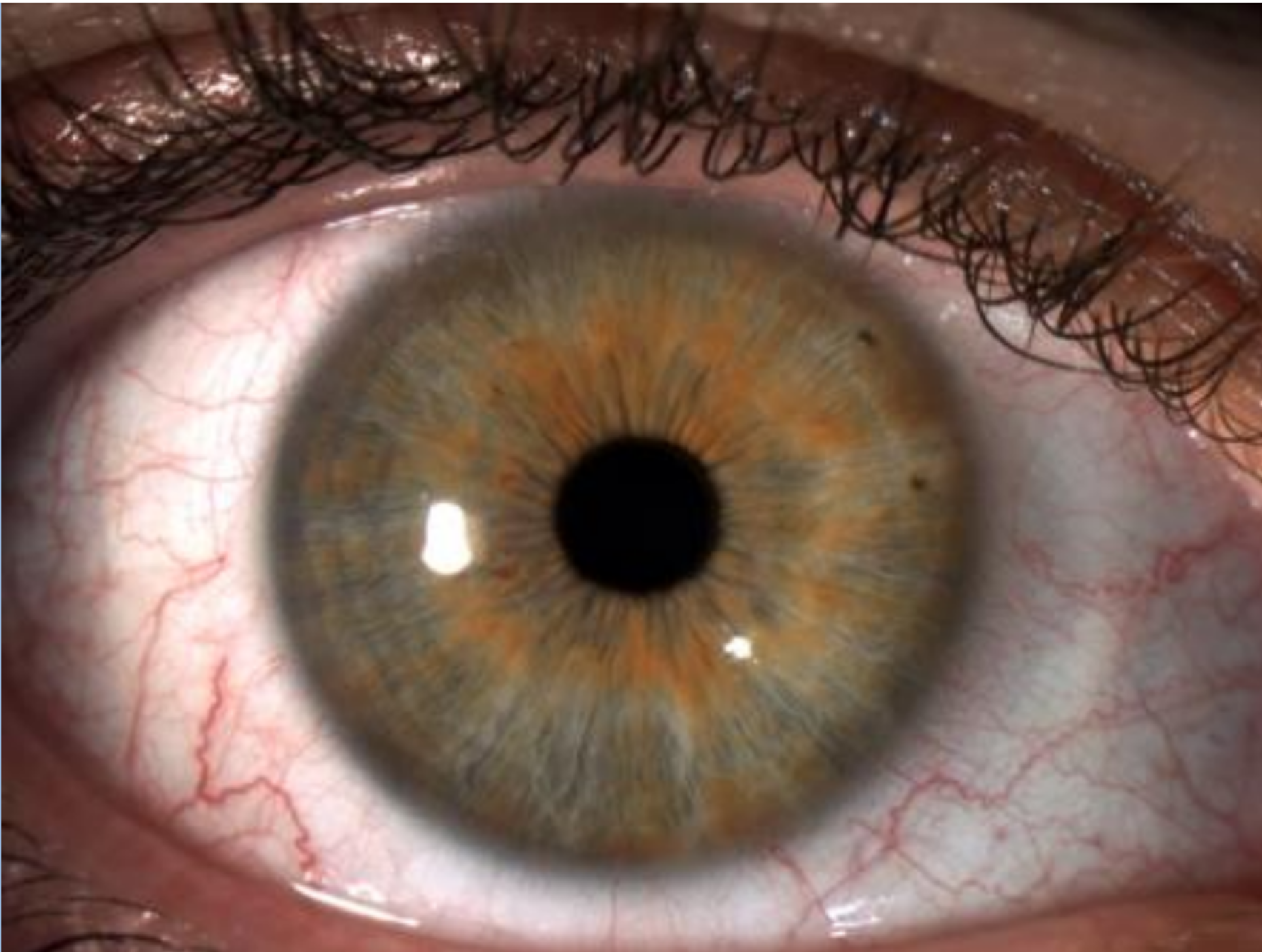 Haag-Streit Slit lamps